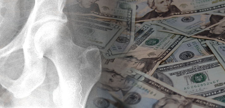 New Study Shows How to Drive Savings in Hip Surgery… And much more ...