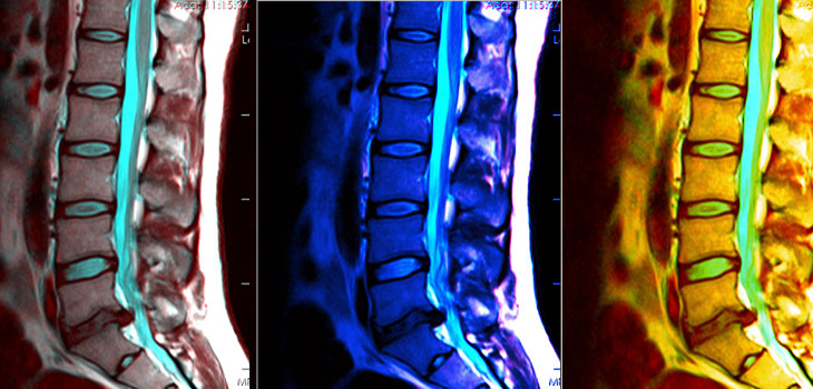 Lumbar Vertebrae Numbers