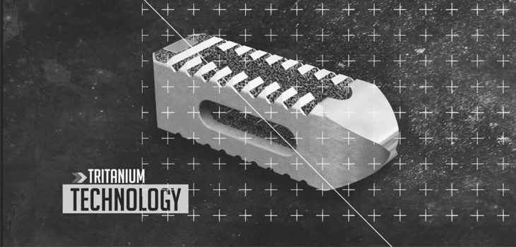 3D Print This! | Orthopedics This Week