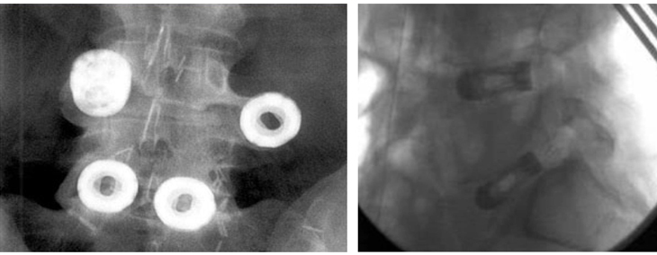 3D Print This! | Orthopedics This Week