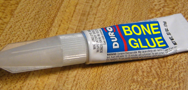 Bone Glue Market: $1,032.9 Million by 2024 | Orthopedics This Week