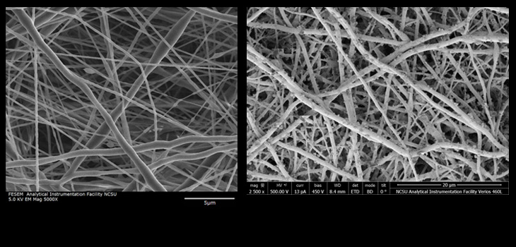 Silver-Releasing Scaffolds Cut MRSA Bone Infection Risk | Orthopedics ...
