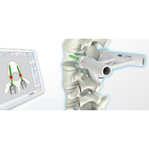 AIP Best Technologies for Spine and Orthopedics | Orthopedics This Week