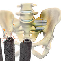 AIP Best Technologies for Spine and Orthopedics | Orthopedics This Week