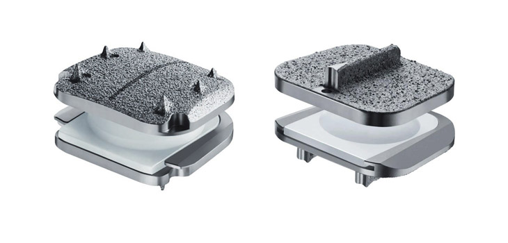 Remember Artificial Disc Replacement? | Orthopedics This Week