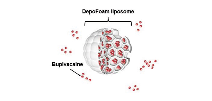 Exparel Cost Effectiveness | Orthopedics This Week