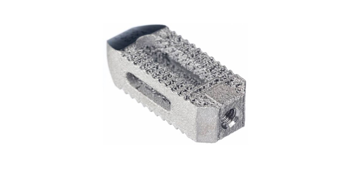 Updating IFU’s for Stryker’s 3D Tritanium Implant | Orthopedics This Week