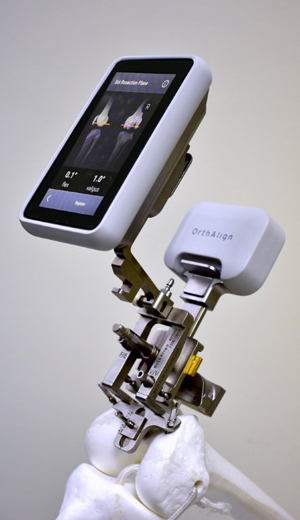 In What Direction Will Surgical Nav/Robots Go From Here? | Orthopedics ...