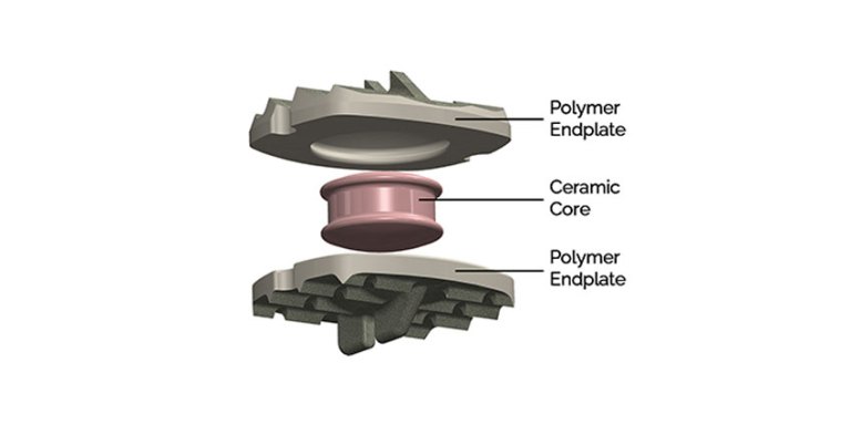 Rare FDA Approval for Simplify Cervical Disc | Orthopedics This Week