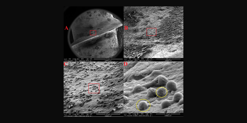 Landmark Study: 1st Visual Biofilm Evidence From “Aseptic” Surgery ...