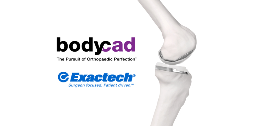 Exactech, Bodycad Team up for Reflex Uni™ Knee - Orthopedics This Week