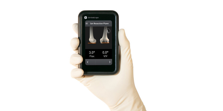 Next Gen ‘Smart Phone’ Surgical NAV for Total Joints (and the ASC ...