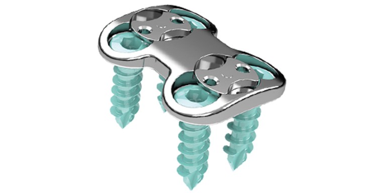 Surgical Efficiency Highlights DePuy Synthes New ALIF Implant System ...