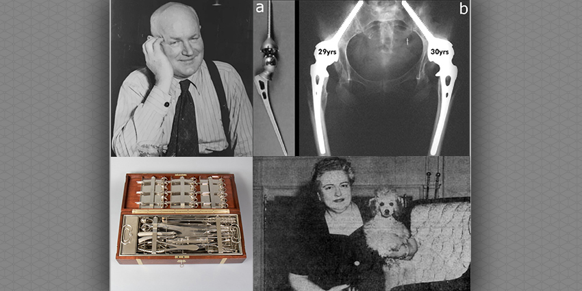 History of Modern Spine Surgery | Orthopedics This Week