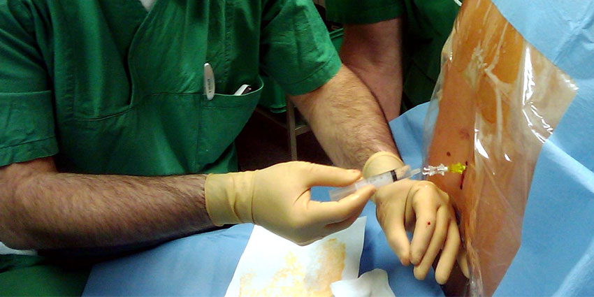 Spinal Vs General Anesthesia 11k Patient Study Picks A Winner