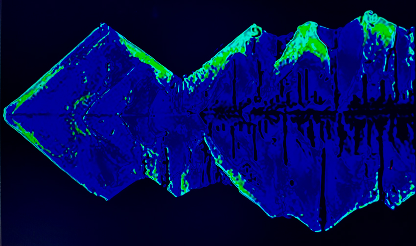 Gil Tepper, M.D.: A Wellspring of Art and Inspiration | Orthopedics ...