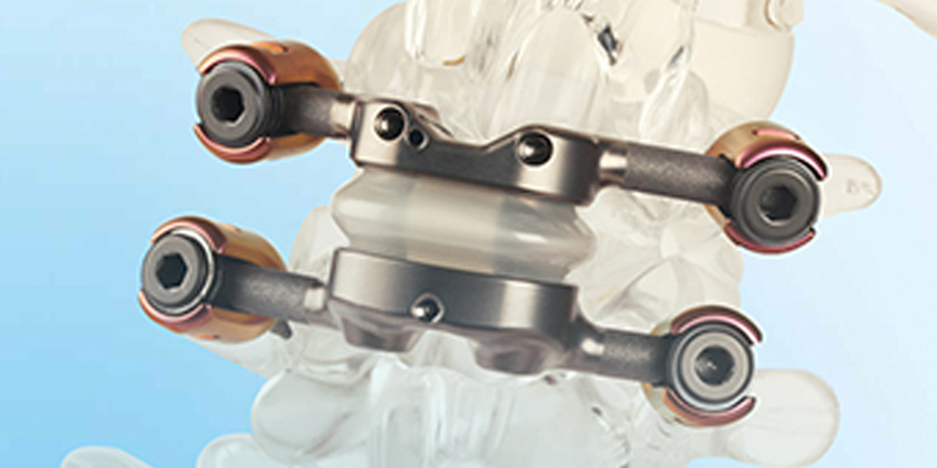 FDA Approves TOPS for Spondylolisthesis and Stenosis - Orthopedics This ...