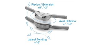 FDA Approves TOPS for Spondylolisthesis and Stenosis | Orthopedics This ...
