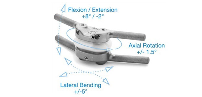 FDA Approves TOPS for Spondylolisthesis and Stenosis | Orthopedics This ...