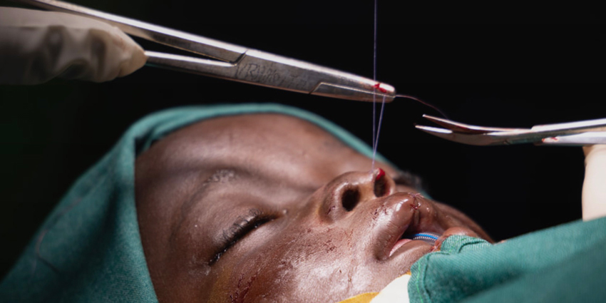 One Surgeon’s Experience Volunteering Internationally | Orthopedics ...