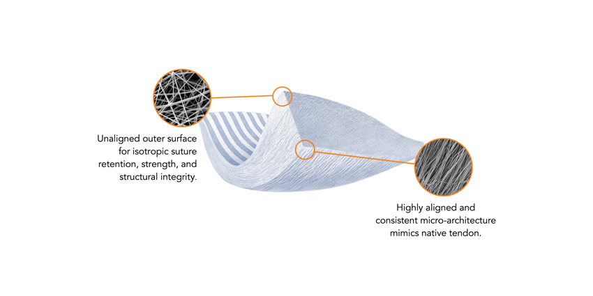 LifeNet Health Sues Zimmer Biomet & Embody for Patent Infringement ...