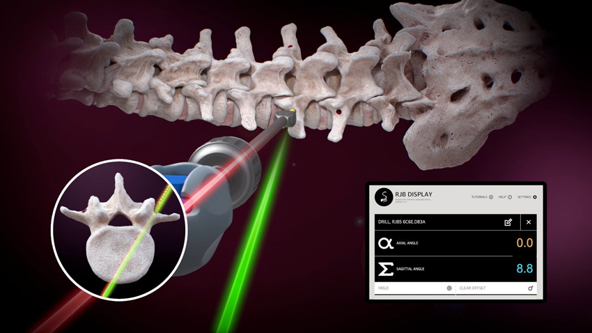 Best New Spine Technologies for 2023 | Orthopedics This Week
