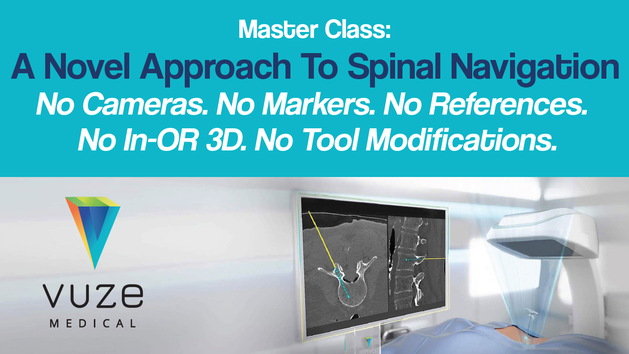 A Novel Approach to Spinal Navigation - Orthopedics This Week
