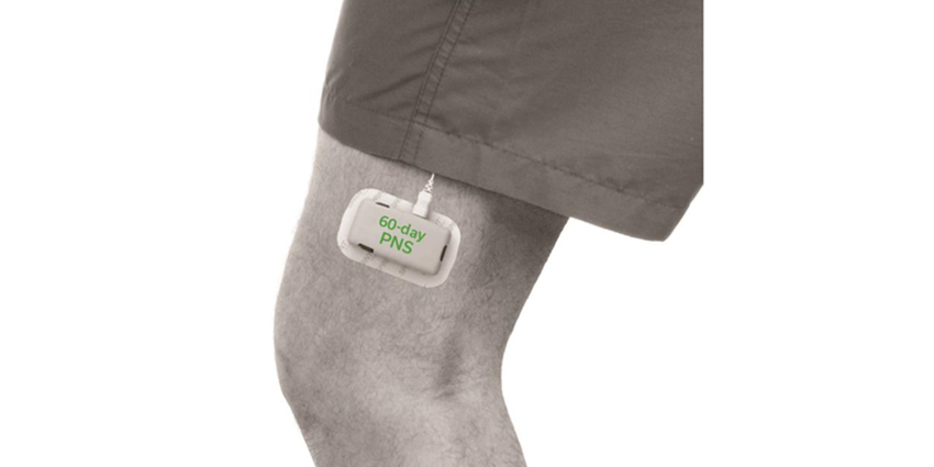 New Study: Nerve Stim Lowers Post Op TKA Pain ≥50% - Orthopedics This Week
