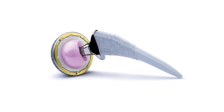 More Versatile, Comprehensive Femoral Hip System Launched - Orthopedics ...