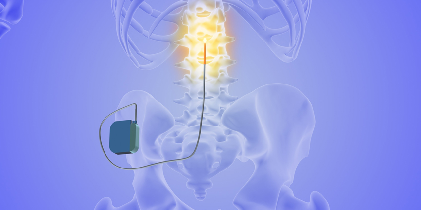 The Real Story Behind Globus’s Nevro Deal - Orthopedics This Week