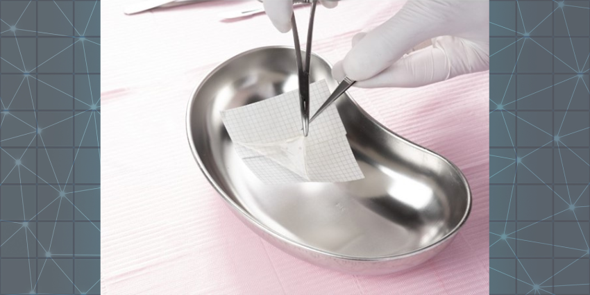 Birth Tissues Put to a High Energy Trauma Test - Orthopedics This Week