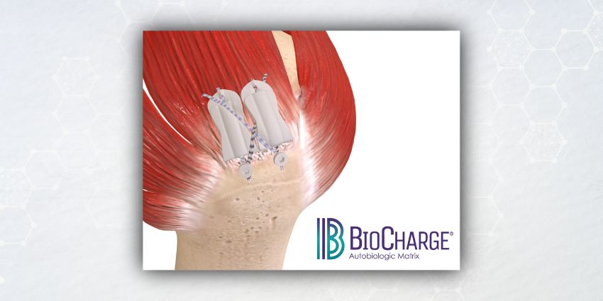 Novel Autobiologic Rotator Cuff Matrix Cleared - Orthopedics This Week