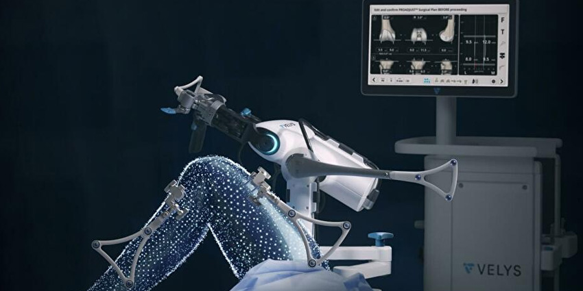 VELYS Robotic TKA: A Short Ramp, Not a Mountain - Orthopedics This Week